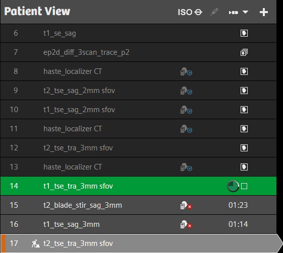 The Importance of Choosing the Right Protocol for MRI Scans - INSCMagazine