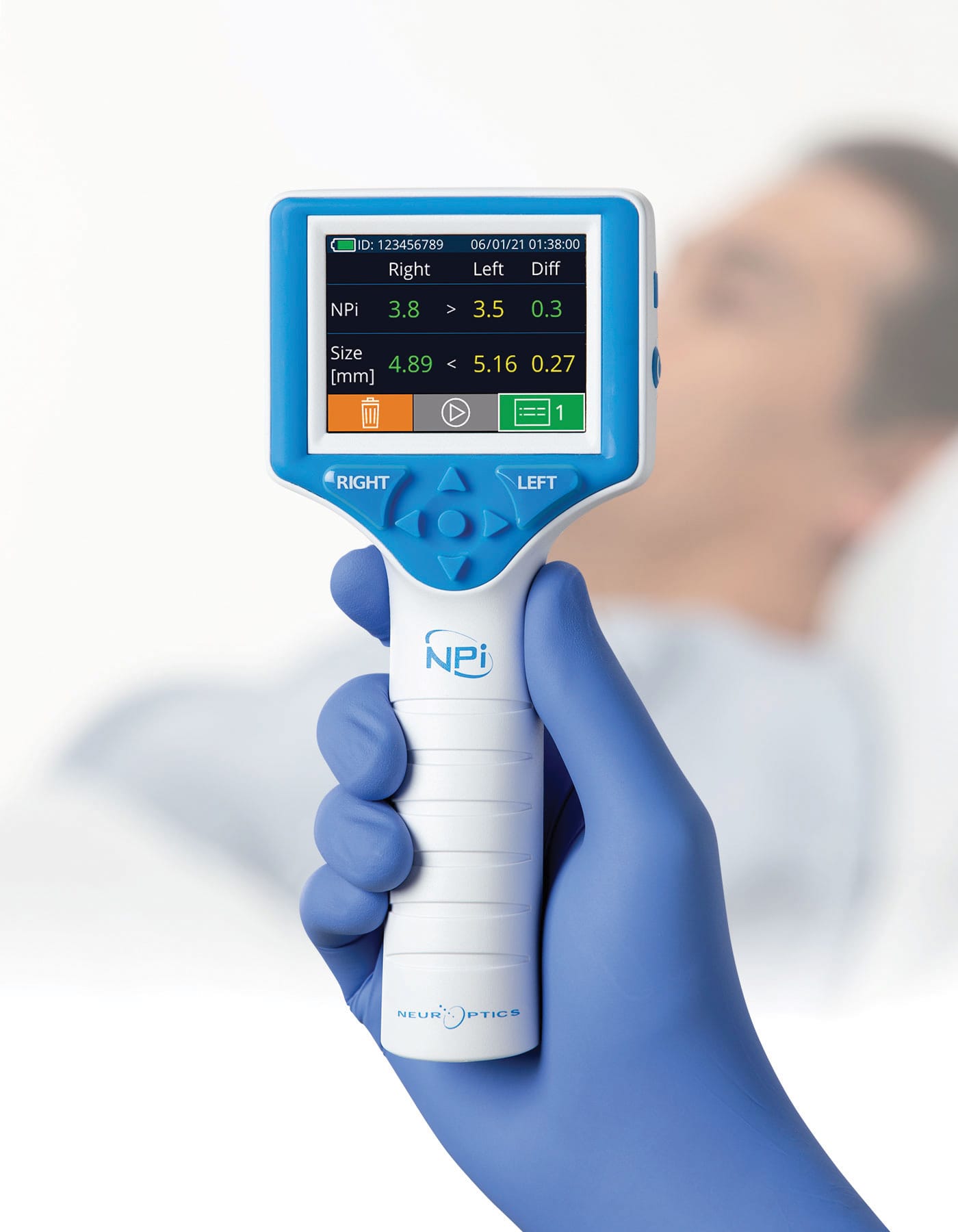 Advancements in Pupil Diameter Measurement: NPi and Neurological Tools ...