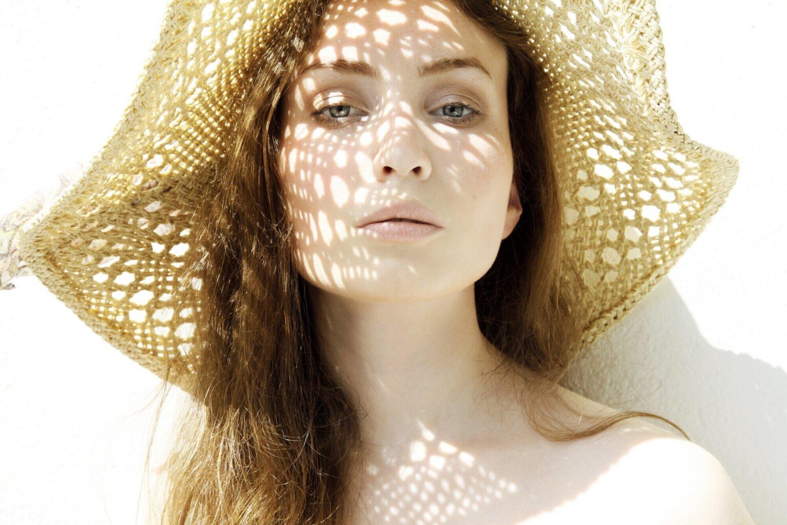 The 5 Key Differences Between Sun Exposure and Melasma vs ...