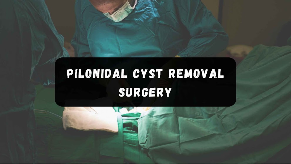 Tips for a Smooth Recovery from Pilonidal Cyst Surgery - INSCMagazine